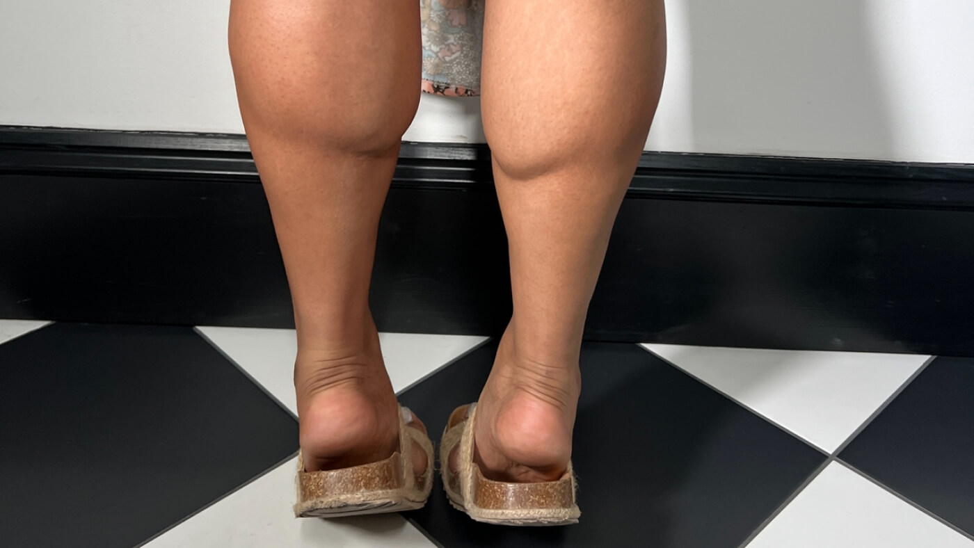 Calf Slimming | Calf Slimming | Faces By Bae
